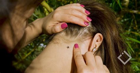 რატომ არის საშიში ტკიპის ნაკბენი და როგორ დავიცვათ თავი პარაზიტებისაგან Adjara Tv