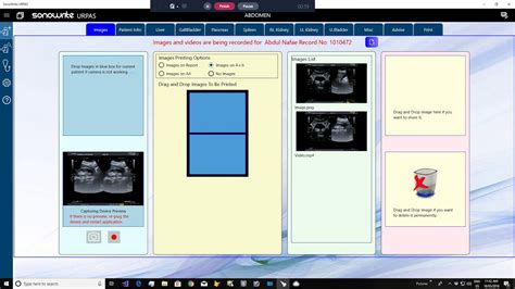Videocapture Youtube