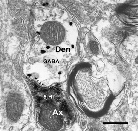 Dual Label Electron Microscopy Observation Showing Serotonergic