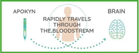 How Do I Take Apokyn® Apokyn® Apomorphine Hci For Pd