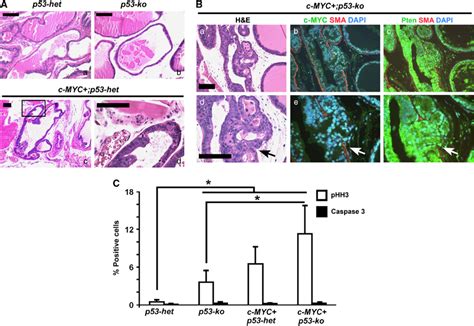 Modest Cooperation Between Focal C Myc Expression And P53 Download Scientific Diagram