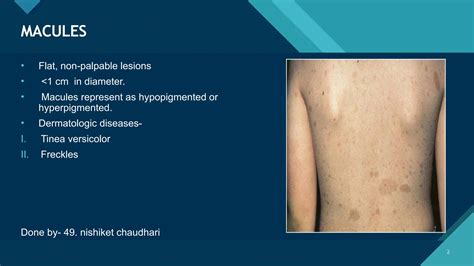 Dermatology Skin Pigmentprimary Lesionspptx