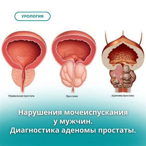 Заболевания мочеполовых органов | Новости медицинского центра Клиника ДНК