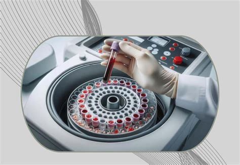 Graphene Impedance Biosensor For Serum Protein Detection