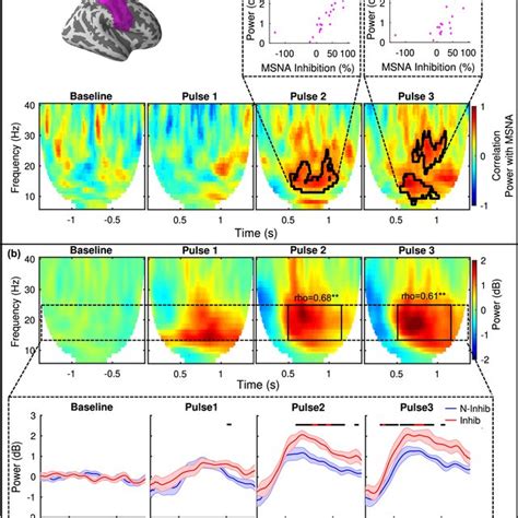 Meg Neural Oscillatory Response And Cortical Thickness In The Insula