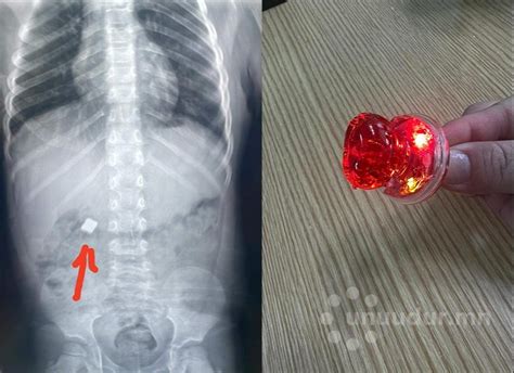 ЭХЭМҮТ өөс шинэ жилээр хүүхдүүддээ товчин зайтай чихэр бэлэглэхгүй байхыг анхааруулав