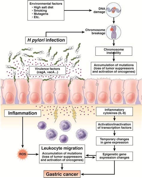 Helicobacter Pylori Update Gastric Cancer Reliable Therapy And Possible Benefits Pmc