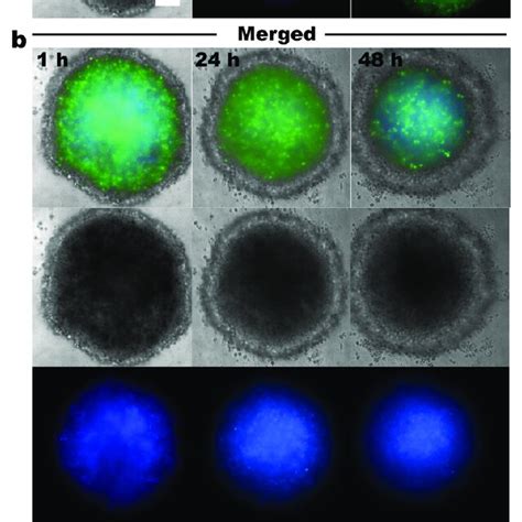 Culture Of Tumor Spheroid Formed By Self Organization Of 3t3 And Hepg2