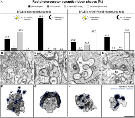 Ultrastructural Analysis Of Rod Photoreceptor Ribbon Synapses In The Download Scientific