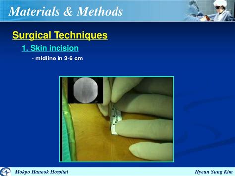 Ppt Mini Open Posterior Decompression And Fusion With Percutaneous