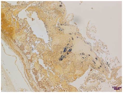 Tissue Gram Stain Of A Formalin Fixed Intestinal Tissue Cross Section