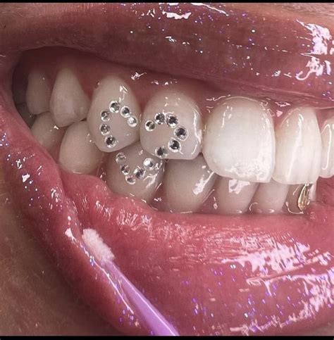 Pin By Minava On Tattoo Models Tooth Gem Pretty Teeth Teeth Jewelry