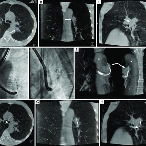 cbct image of a slice of the catphan phantom used to determine the