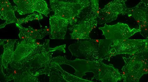 Particle Targeting In Complex Biological Media Advanced Science News