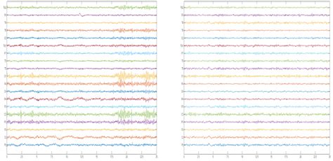 Deep Convolutional Neural Network Model For Automated Diagnosis Of Schizophrenia Using Eeg Signals