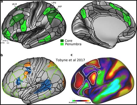 A The Extended Md System Black Contours Correspond To The Hcp Mmp10