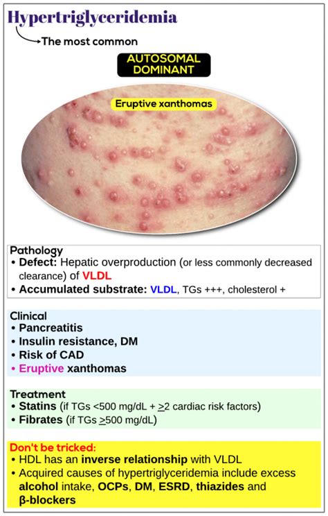 Hypertriglyceridemia Type Iv Medicine Keys For Mrcps