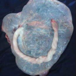 Photographs Showing Different Placenta Shapes Download Scientific Diagram
