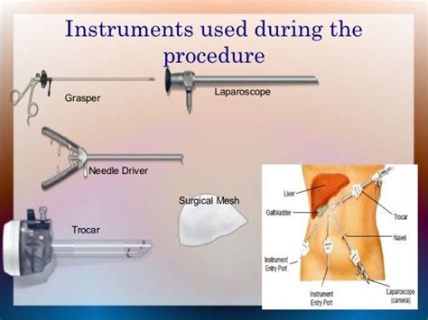 Instruments and Devices Used in Laparoscopic Surgery » Medicomart.in | Laparoscopic surgery ...
