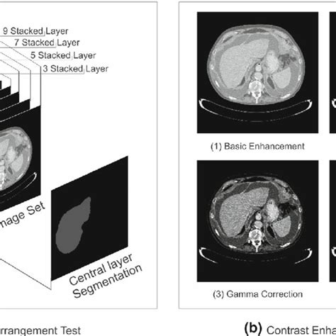 Overview Of Convolutional Neural Network Model Architecture That Download Scientific Diagram