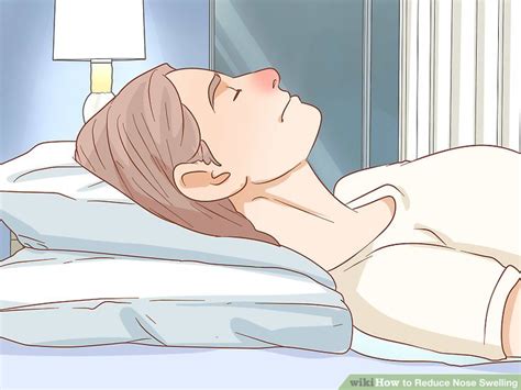 Easy Ways To Reduce Nose Swelling WikiHow