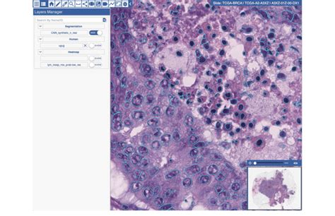 Visualization Of Nucleus Segmentation Results As An Overlay Of Polygons