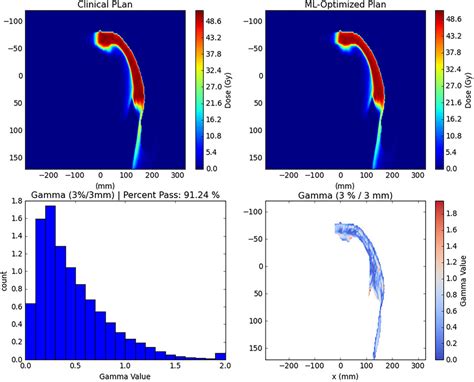 Automated Treatment Planning For Proton Pencil Beam Scanning Using Deep