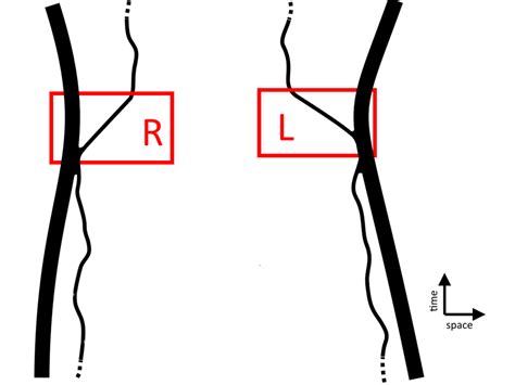spacetime structures involving alleged non machines thin lines
