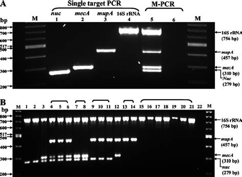 M Pcr Identifies All Staphylococci Discriminates S Aureus From Cons Download Scientific