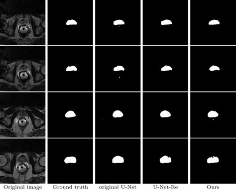 comparison of original u net u net re and ours download scientific