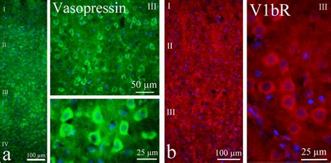 AVP And Its Receptors In The Cerebral Cortex A AVP Expression Was Download Scientific Diagram