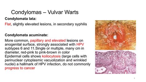 Lec 24 24 Female Reproductive System Pathology Pptx