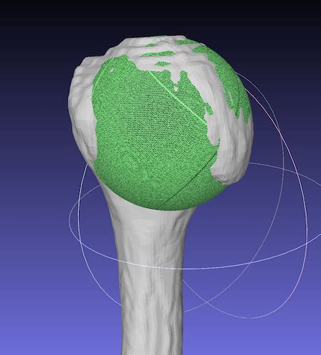 Best Fit Sphere on Point Cloud by Python Script医療のためのPythonプログラミング