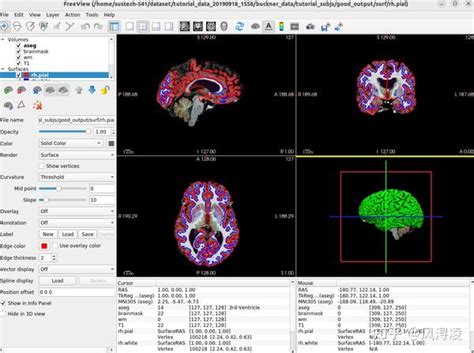 Freesurfer下载安装，常用术语和recon All命令 知乎