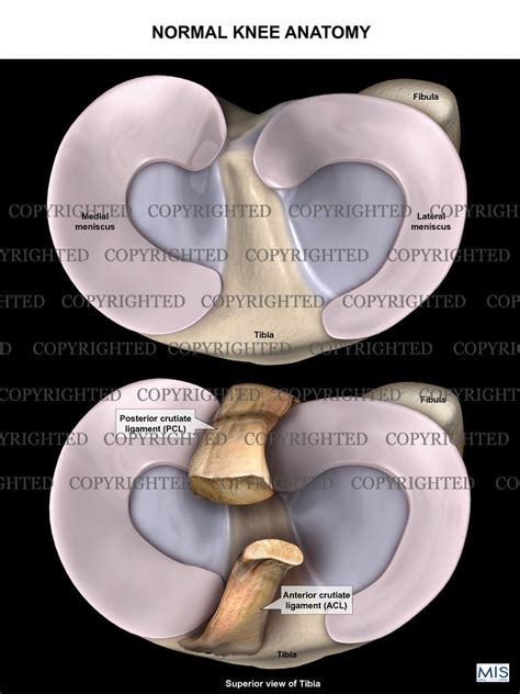 Medial Meniscus Anatomy Posterior Horn