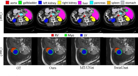 Figure 1 From Optimizing Vision Transformers For Medical Image Segmentation Semantic Scholar