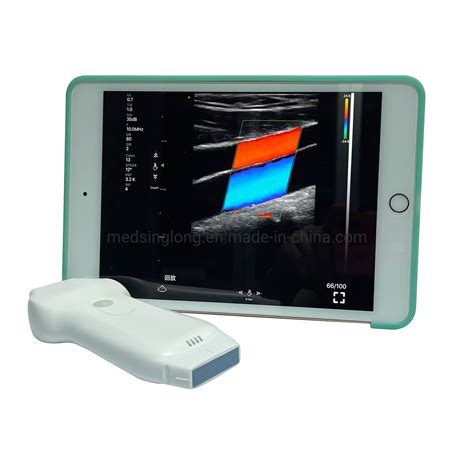 Portable Linearconvexphased Array Double Head Probe Wireless Color