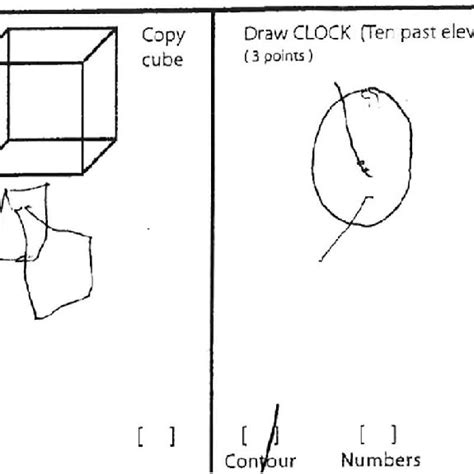 Moca Clock Drawing Examples At Quincy James Blog