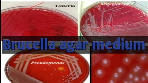 Brucella Agar Medium Culture Media Lecture 19 YouTube