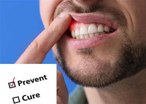 The Insiders Guide To Benefits Of Keeping Wisdom Teeth