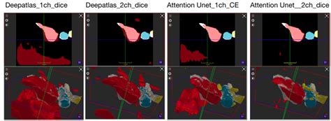 Top Row 2d Cross Sectional View Of The Predictions Overlaid Over The