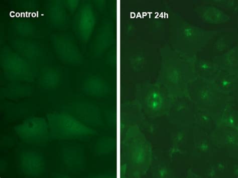 Gamma Secretase Activity Assay Cell Line Cells Online