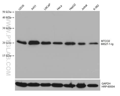 Mtco2 Antibody 68527 1 Ig Proteintech