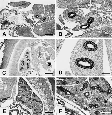 Shh Expression During The Early Pseudoglandular Stage Of Lung
