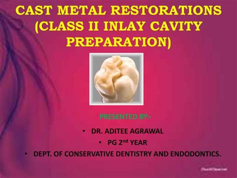 Bevels In Dental Restorations Pptx
