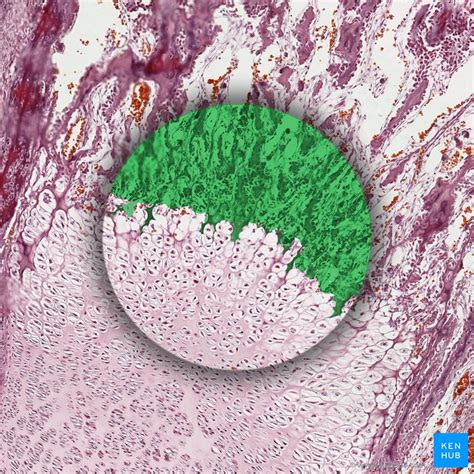 What Does The Bone Matrix Consist Of At Michael Hooton Blog
