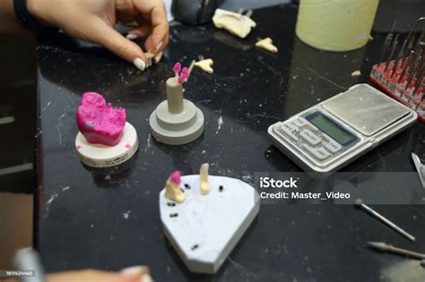 세라믹으로 만든 치과용 크라운 및 의치 제작 치아의 석고 캐스트 스캔 치과에서 세라믹 의치 제작 임플란트용 세라믹 치과용 크라운 3차원 형태에 대한 스톡 사진 및 기타