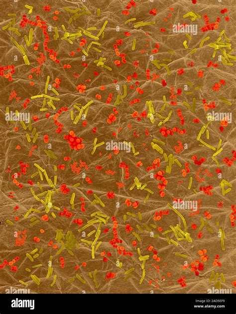 Coloured Scanning Electron Micrograph Sem Of Photocomposite Of Bacteria On Human Skin Types