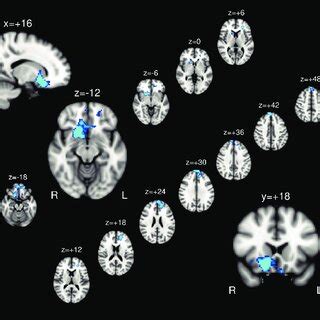 Anterior Piriform Connectivity Regions That Showed Significantly Download Scientific Diagram