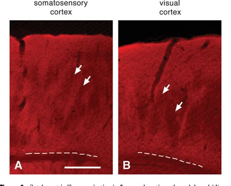 Figure 1 From Unusual Patch Matrix Organization In The Retrosplenial Cortex Of The Reeler Mouse